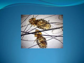 Anoplura | PPTX