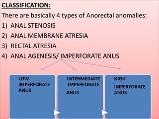 Anorectal Malformation | PPT