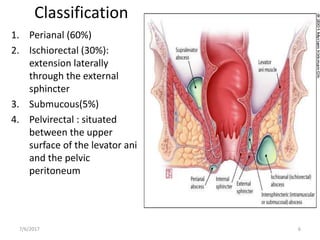 Perirectal Abscess Vs Perianal Abscess