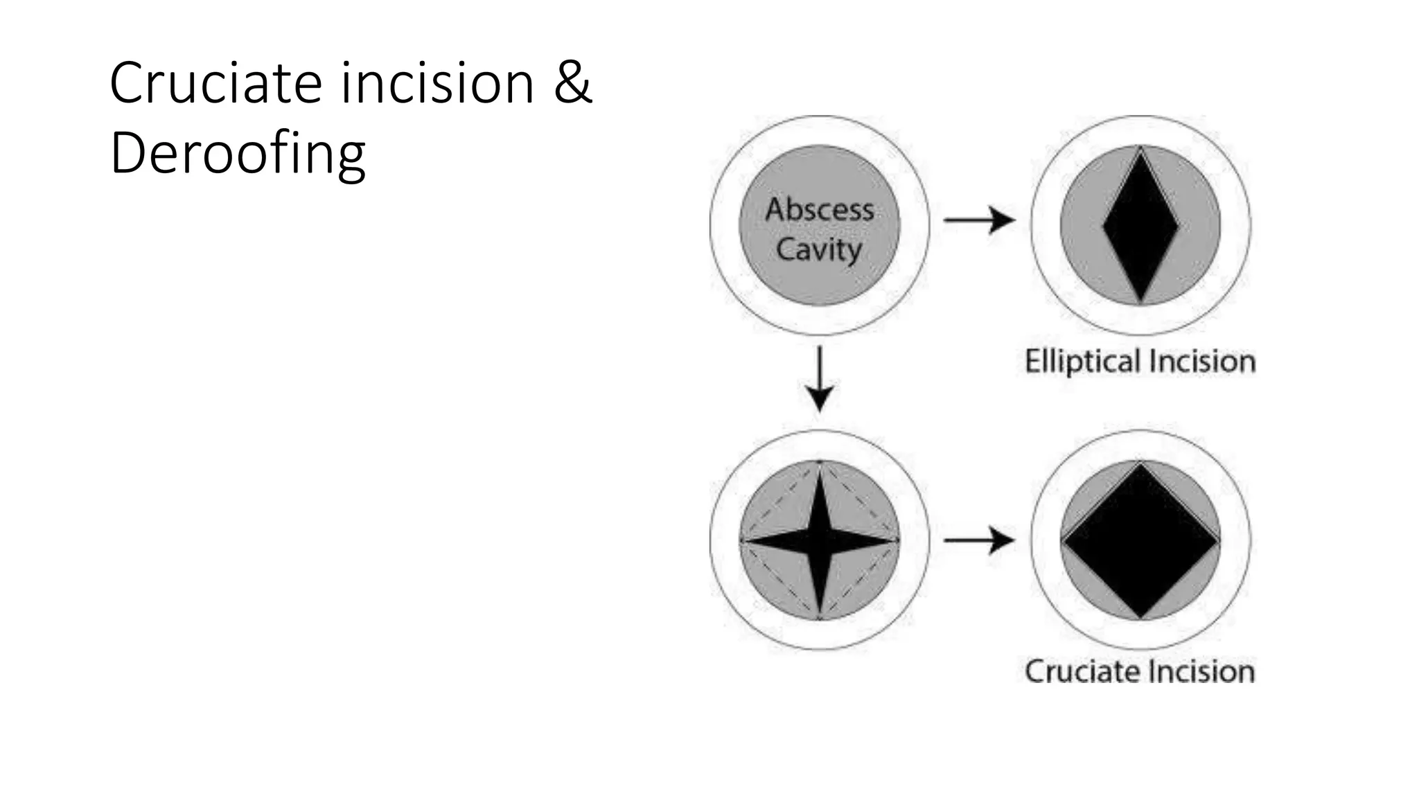 Anorectal Abscess.pptx