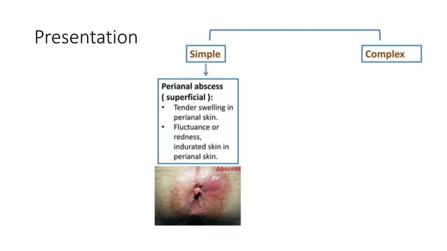 Anorectal Abscess.pptx | Digestive Disorders | Diseases and Conditions