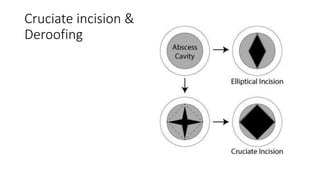 Anorectal Abscess.pptx