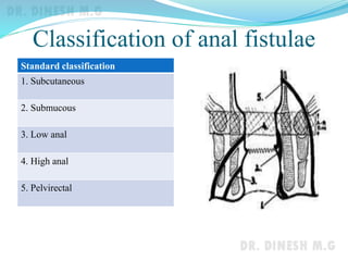 Anorectal abscess & Anal fistulae | PPTX