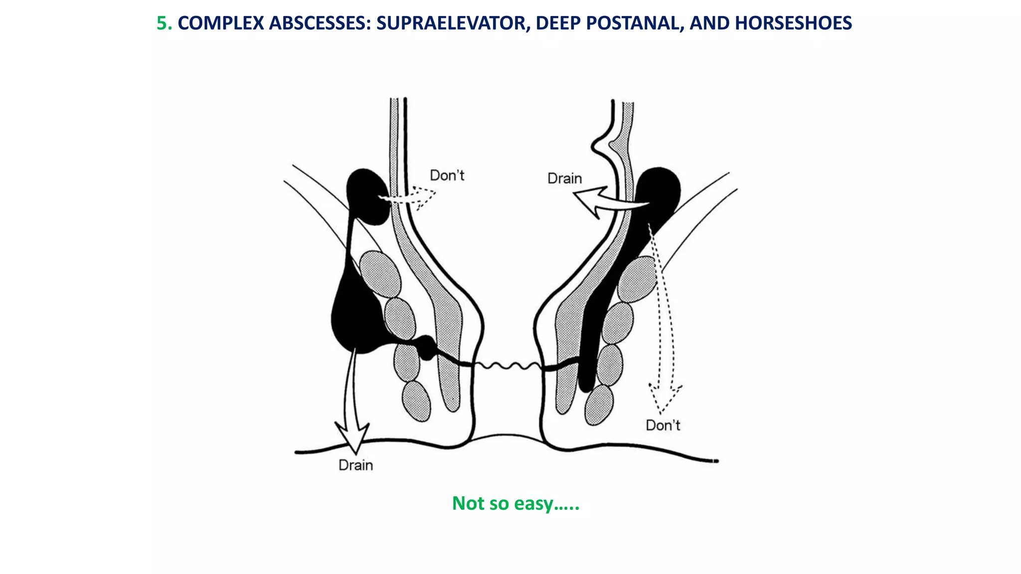 Anorectal abscess and fistula in ano | PPT | First Aid | Injuries