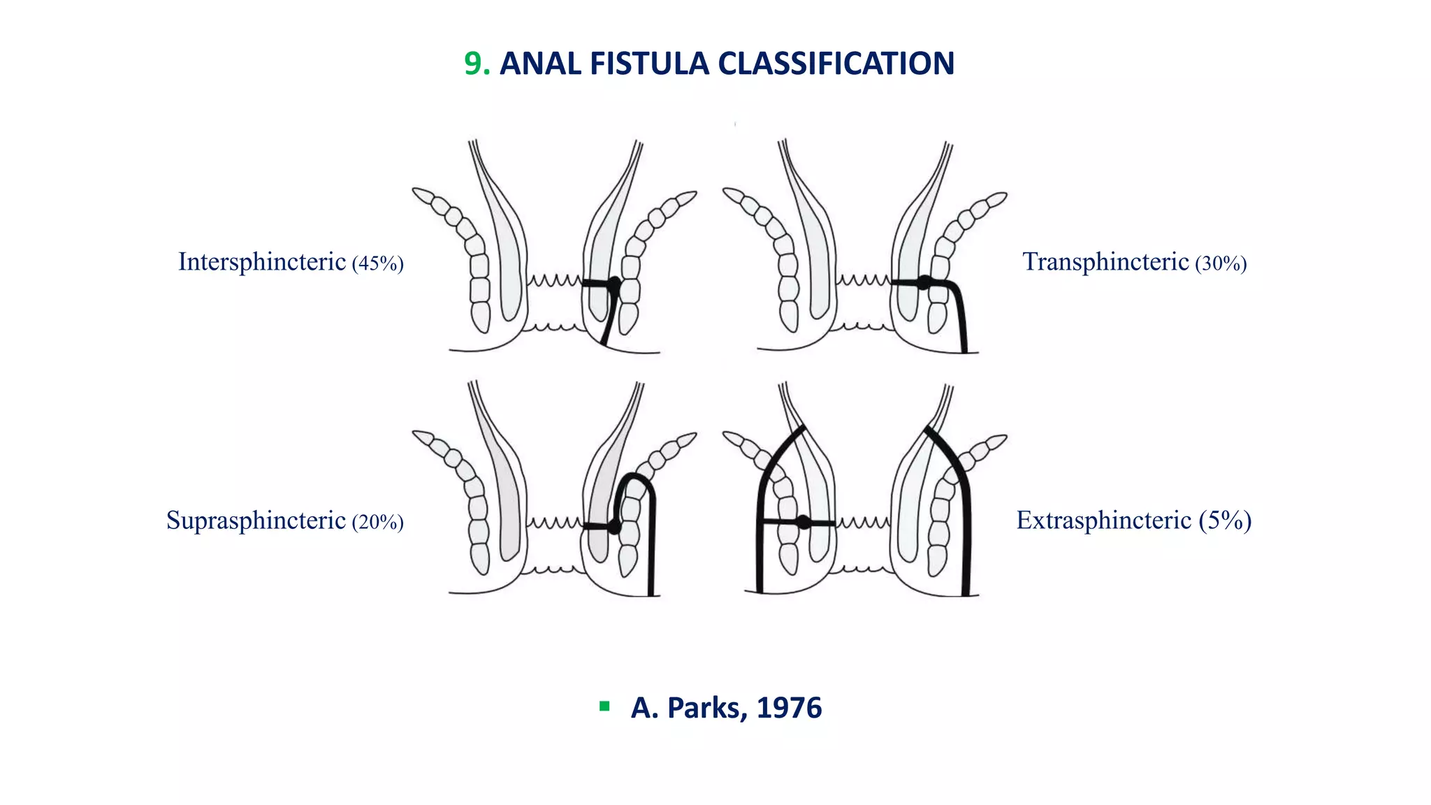 Anorectal abscess and fistula in ano | PPT | First Aid | Injuries