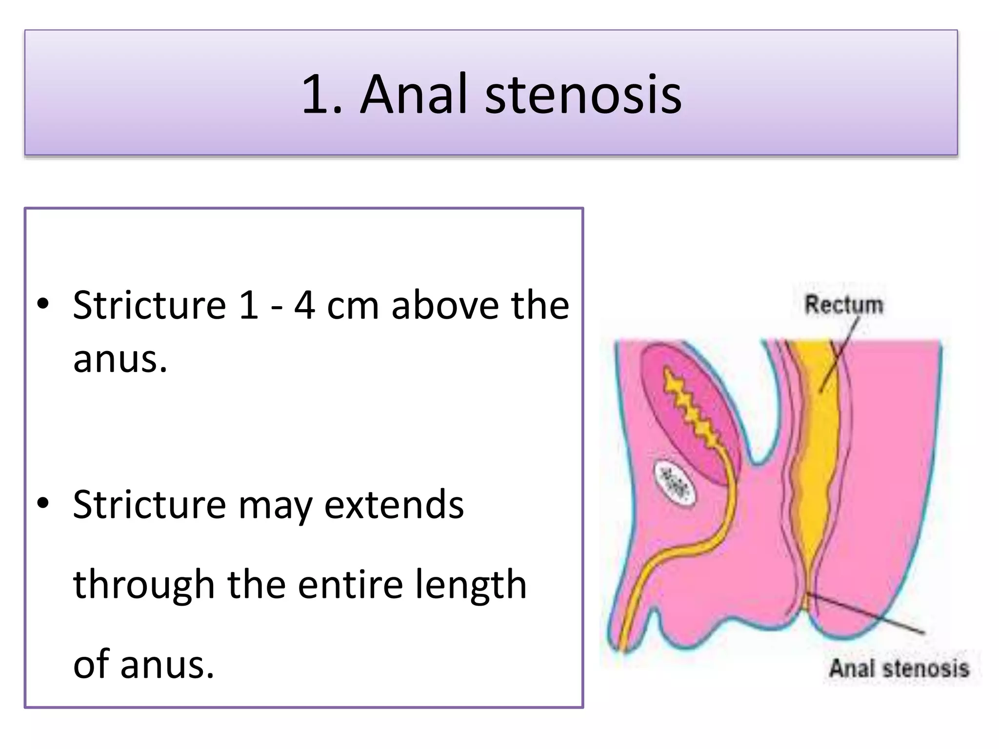 Anorectal Malformation | PPTX | Pregnancy | Reproductive Health
