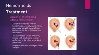Anorectal diseases | PPTX