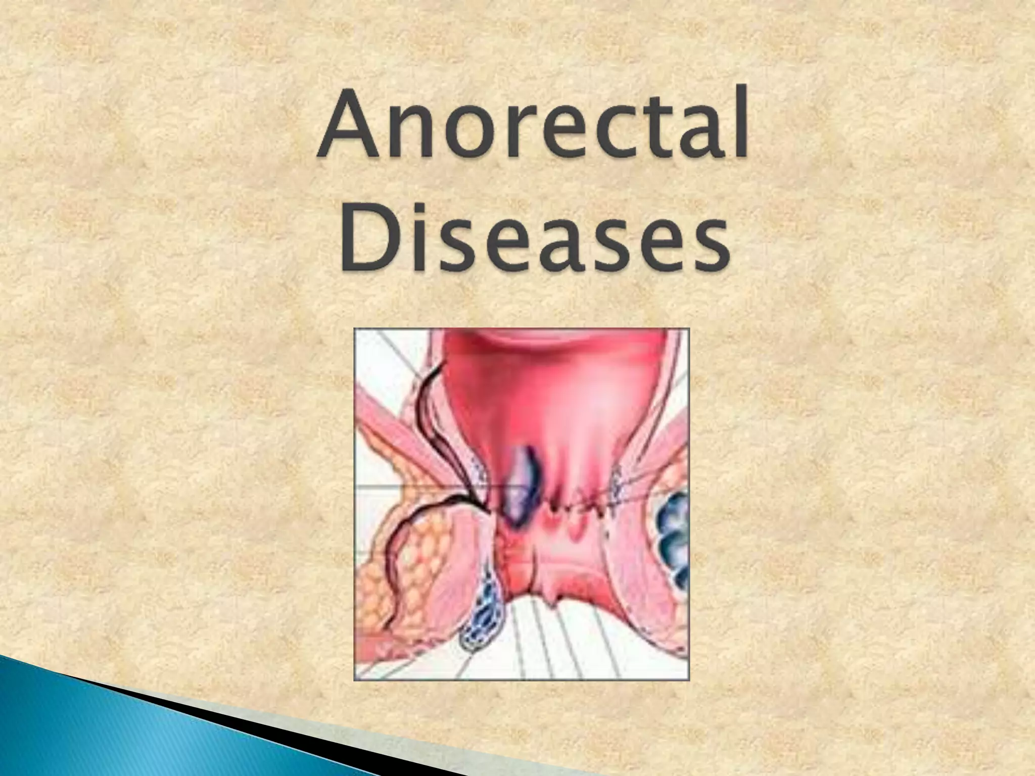 Anorectal diseases | PPTX