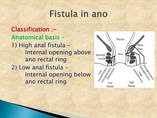 Anorectal diseases | PPTX