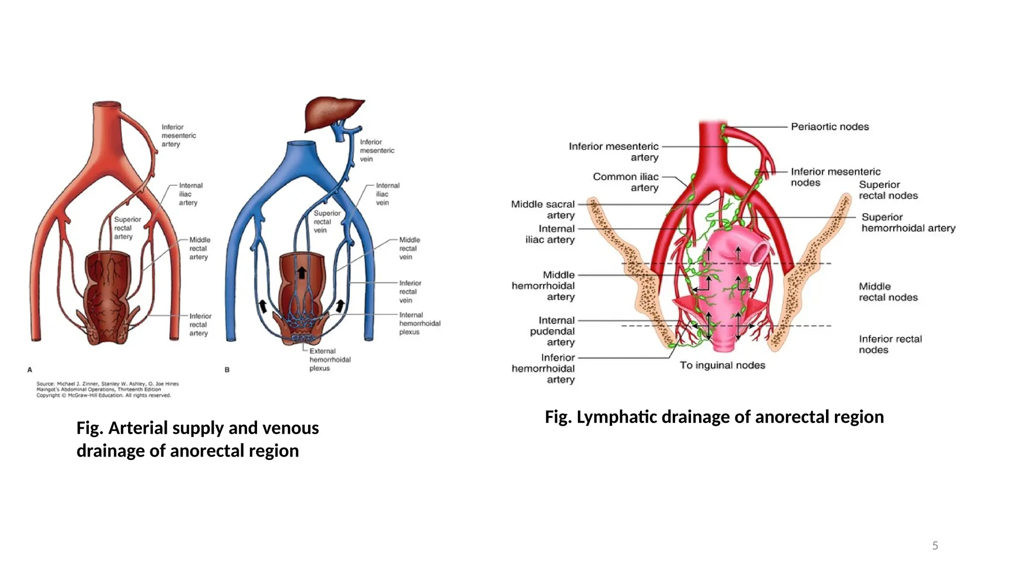 Benign anorectal disorders: Hemorrhoids, anal fissure, SRUS, Perianal ...