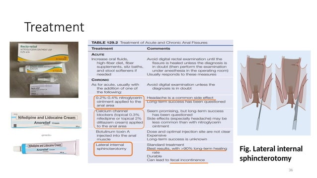 Benign anorectal disorders: Hemorrhoids, anal fissure, SRUS, Perianal ...
