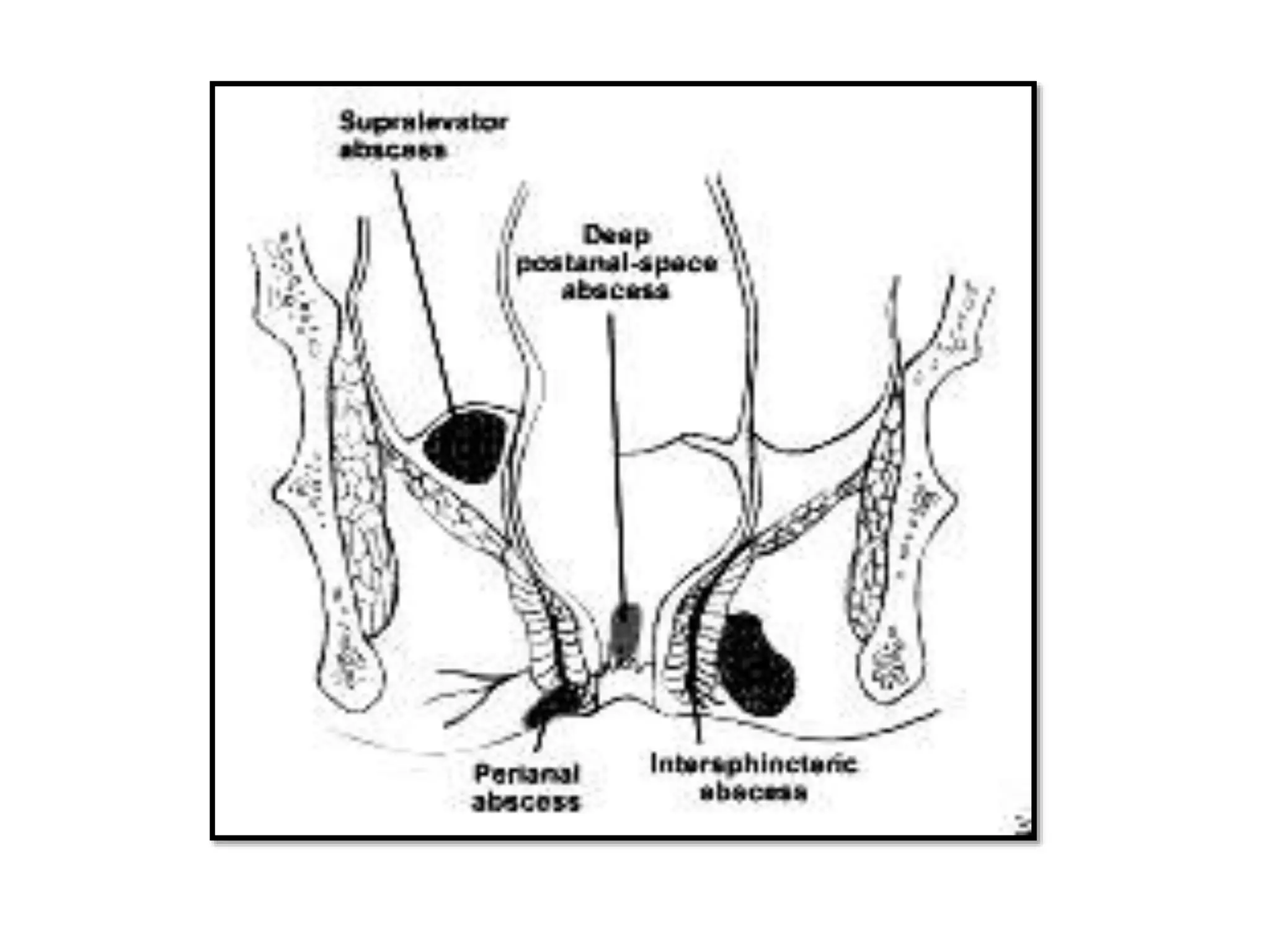 Anorectal disorders | PPTX | Digestive Disorders | Diseases and Conditions