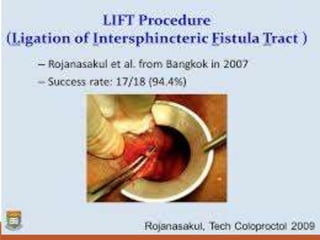 AnoRectal fissure,Abscess &fistula | PPTX