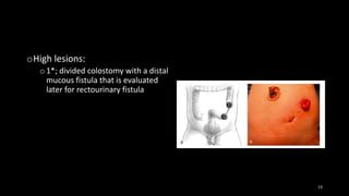 Anorectal malformation-Jimma University | PPTX