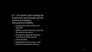 Anorectal malformation-Jimma University | PPTX