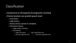 Anorectal malformation-Jimma University | PPTX