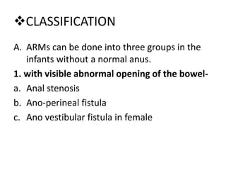 Anorectal malformation | PPTX