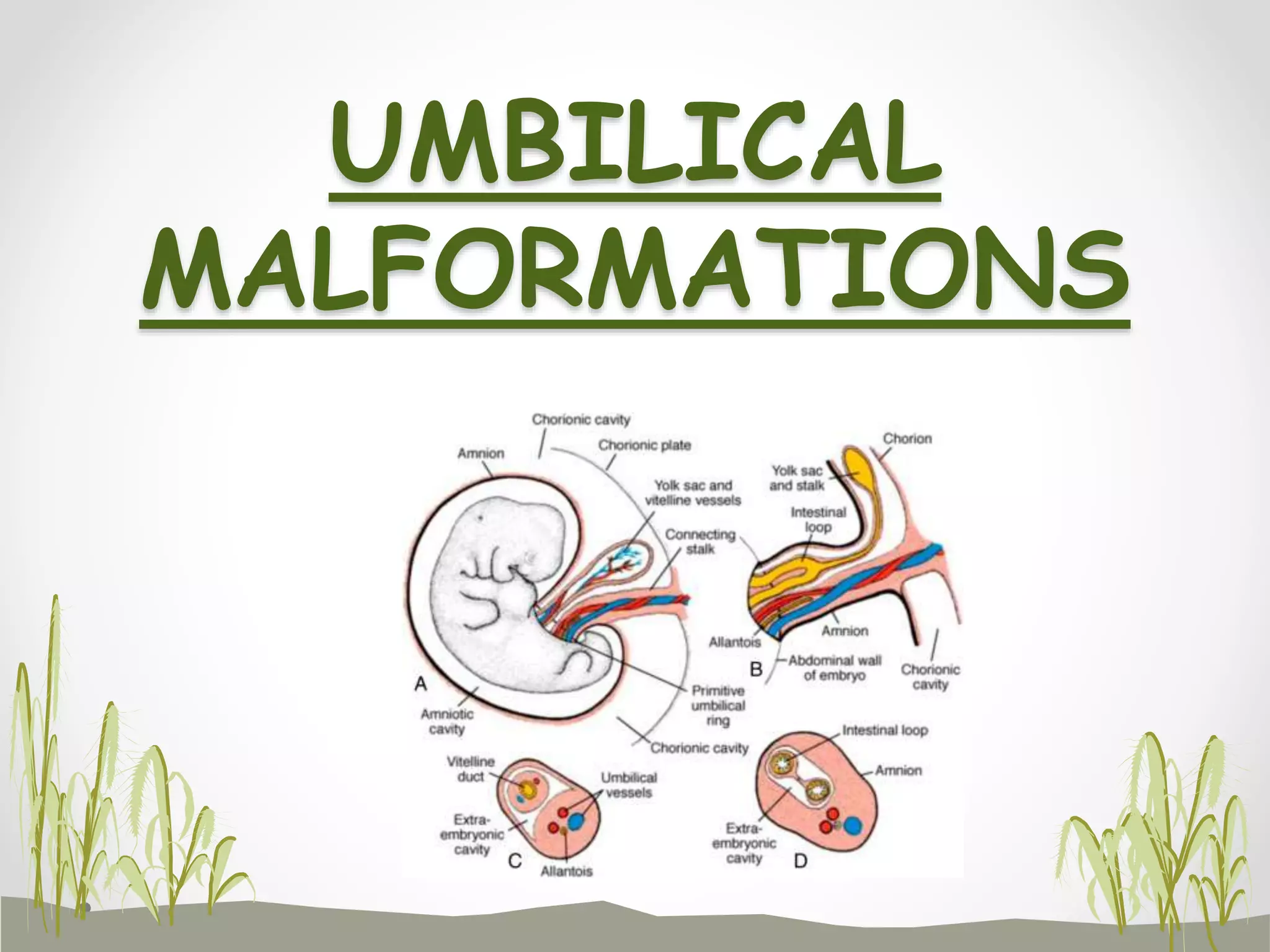 Anorectal malformation | PPTX