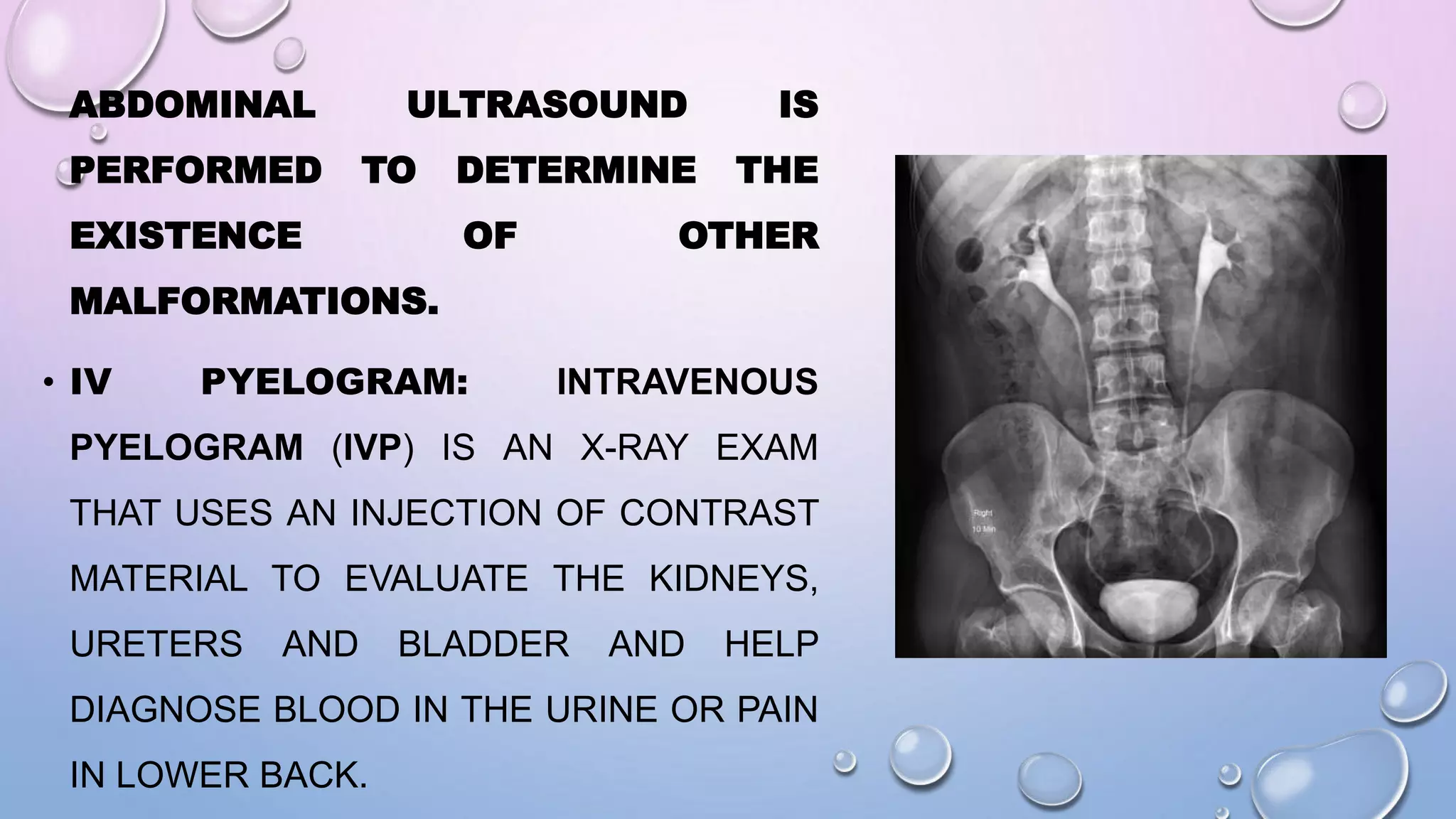 Anorectal Malformation for BSc Nursing/PB BSc Nursing | PPTX