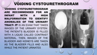 Anorectal Malformation for BSc Nursing/PB BSc Nursing | PPTX