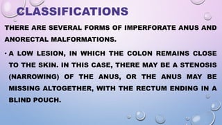Anorectal Malformation for BSc Nursing/PB BSc Nursing | PPTX