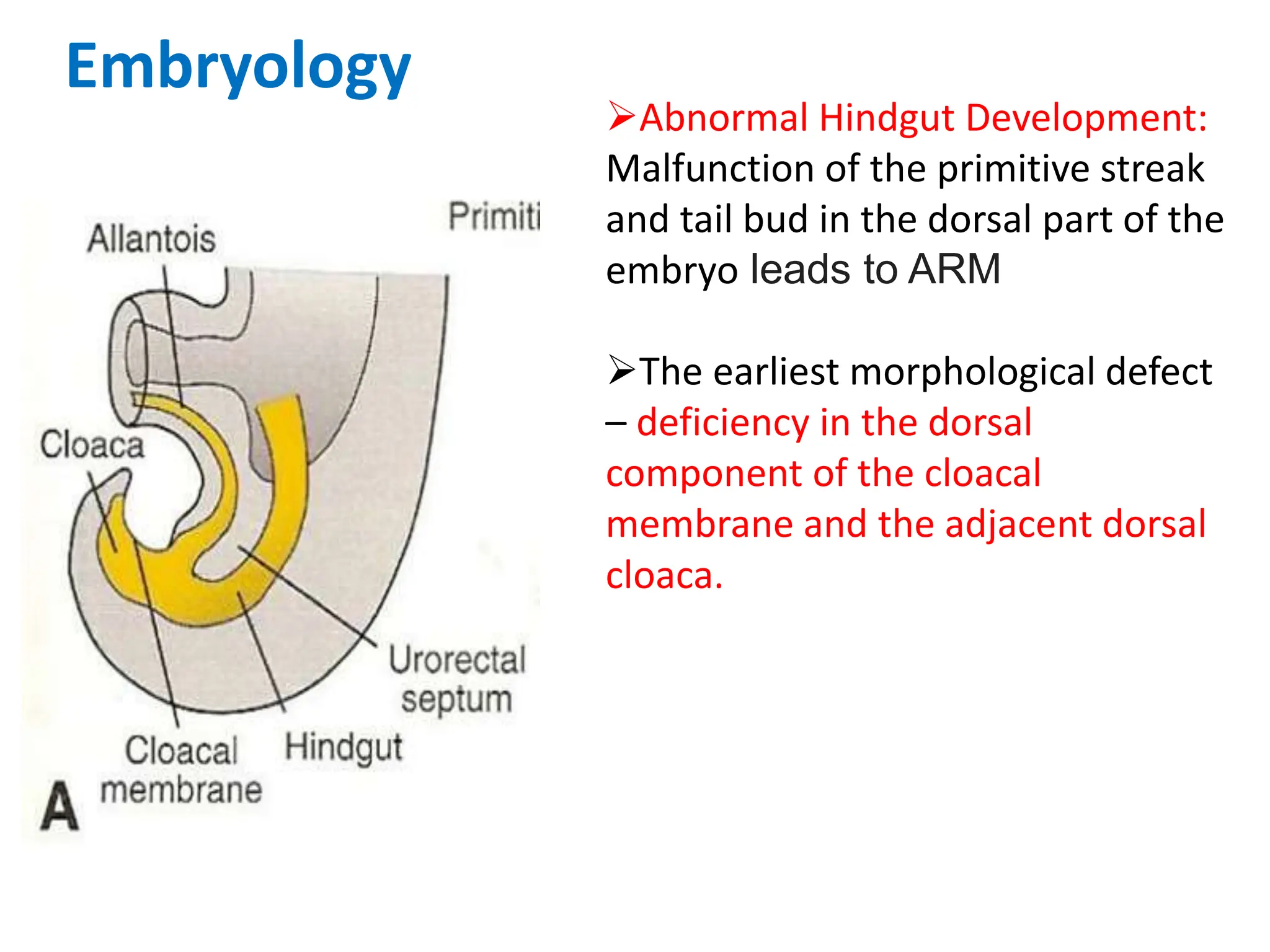 Anorectal malformation.pptx