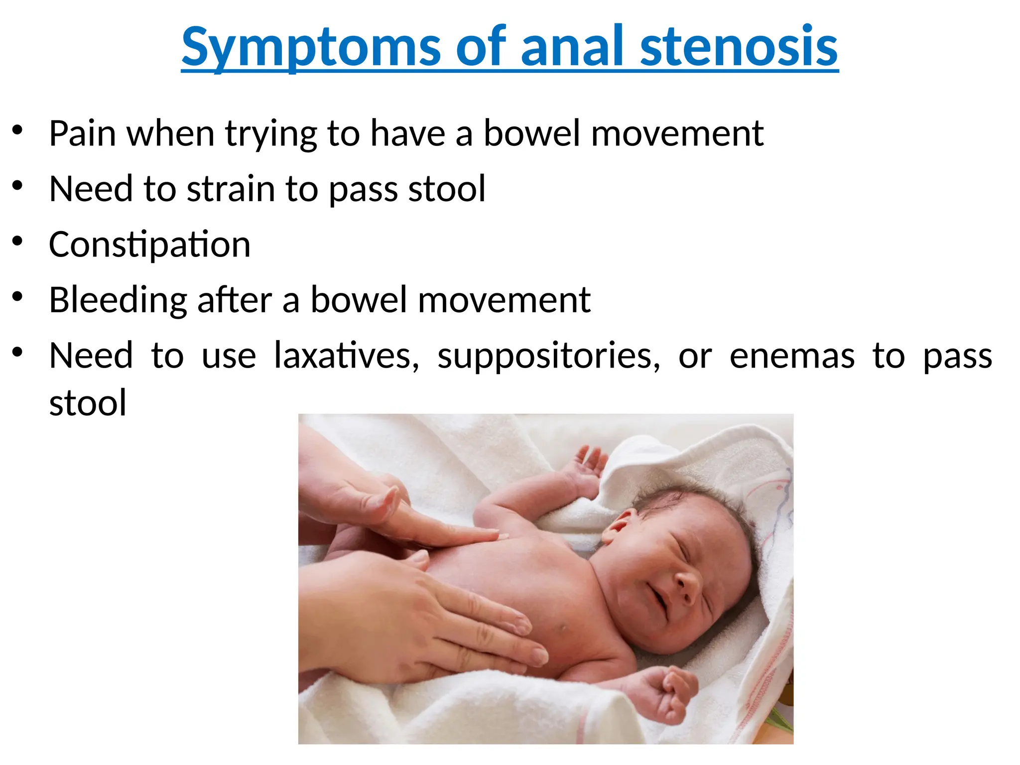 anorectal malformation. pptx | PPTX