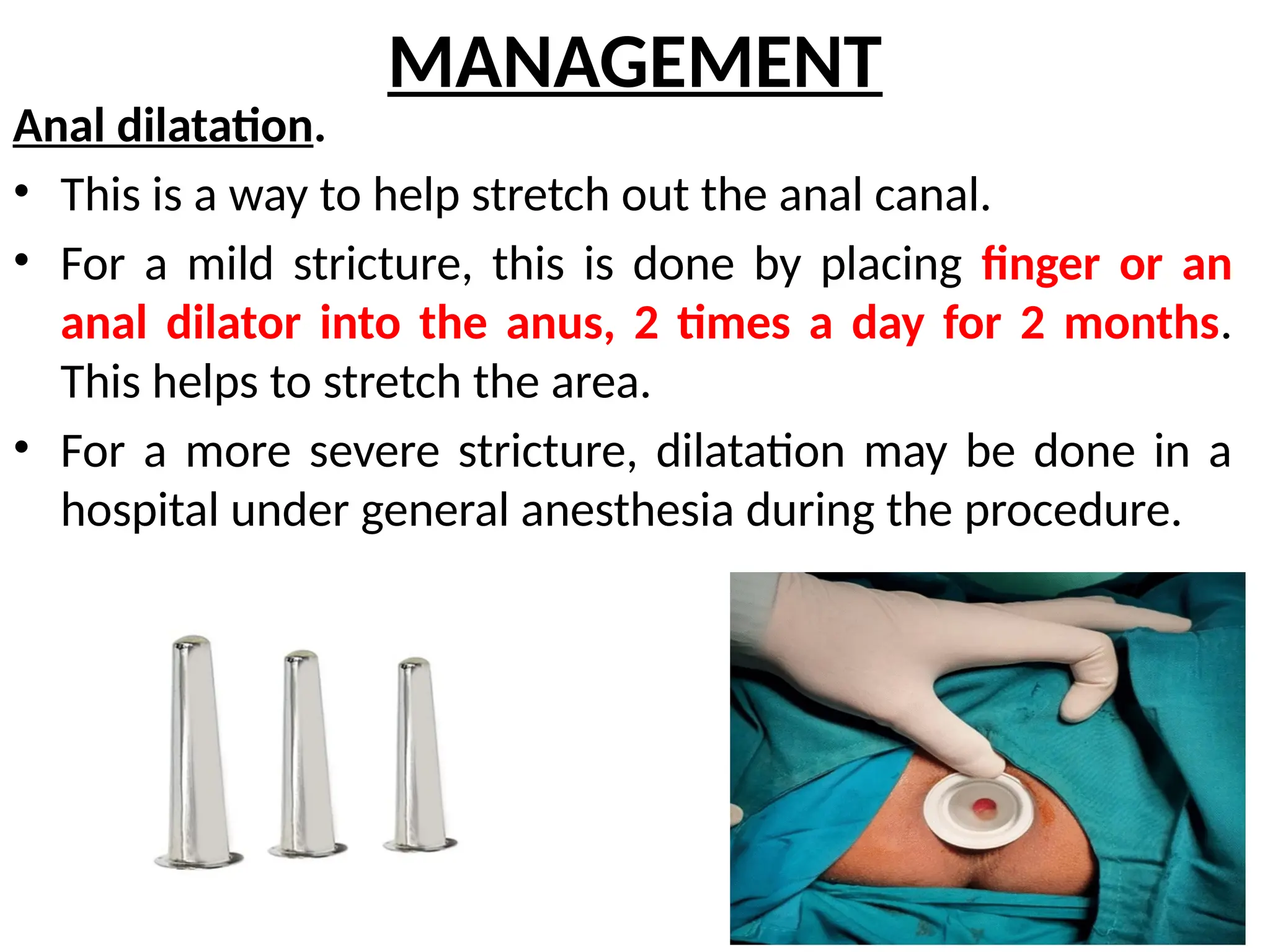 anorectal malformation. pptx | PPTX