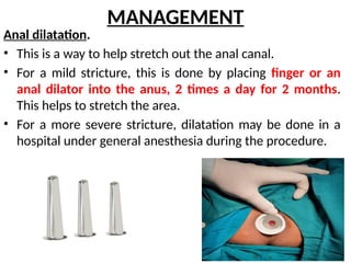 anorectal malformation. pptx | PPTX