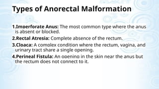 Anorectal Malformation. Surgery Presentation | PPTX