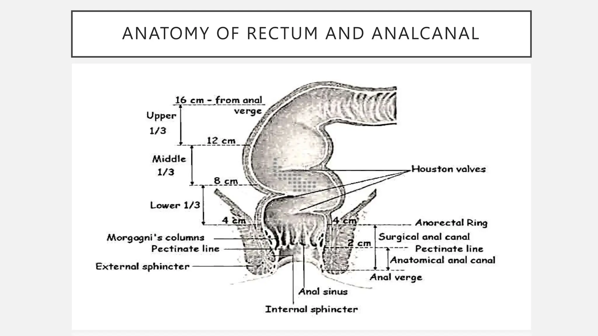 Anorectal Malformation general surgery.pptx