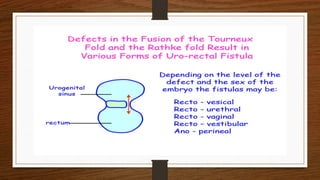 Anorectal malformation (embryology and classification) [Autosaved].pptx