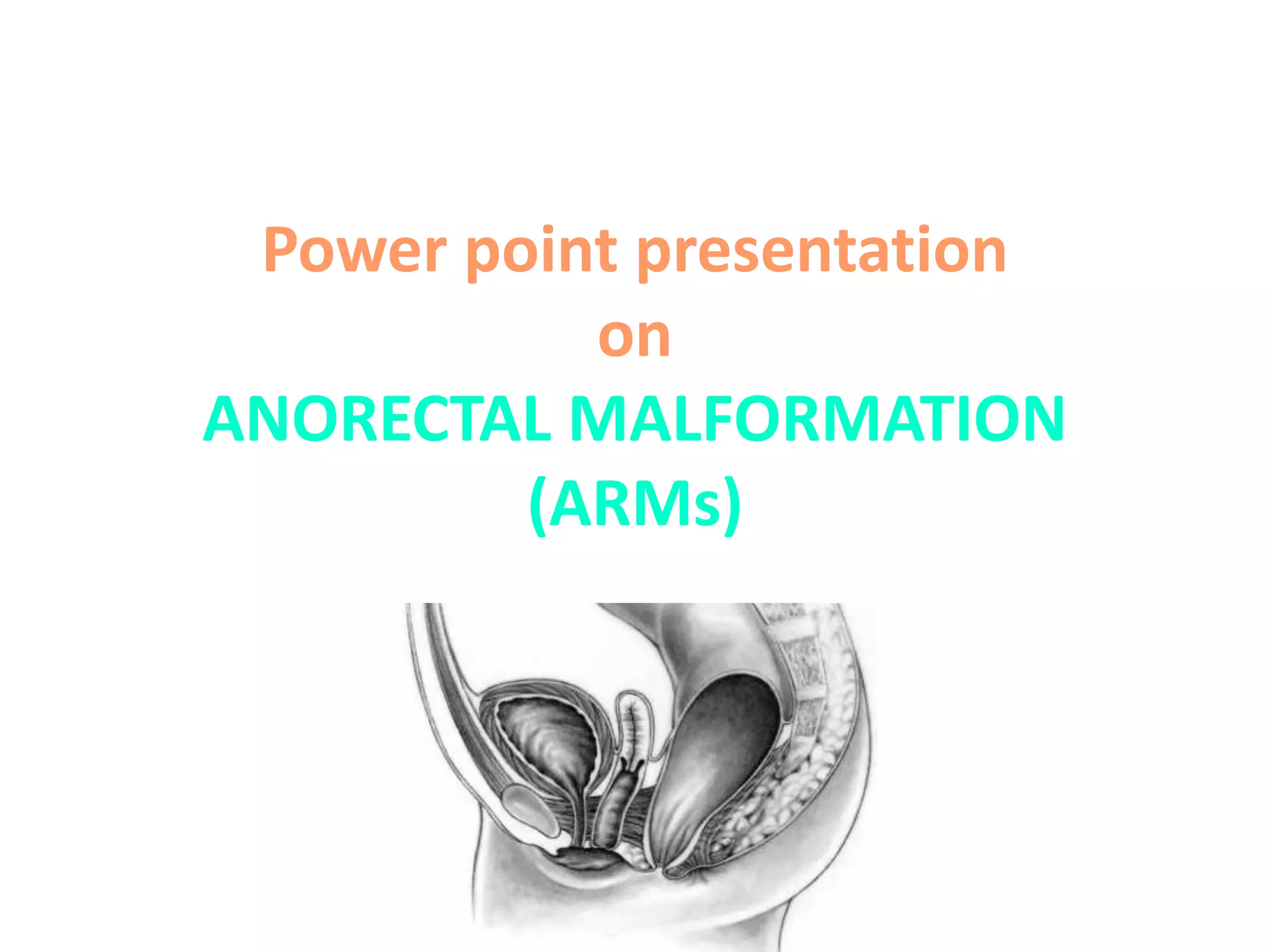 Anorectal malformation ppt 5 | PPT