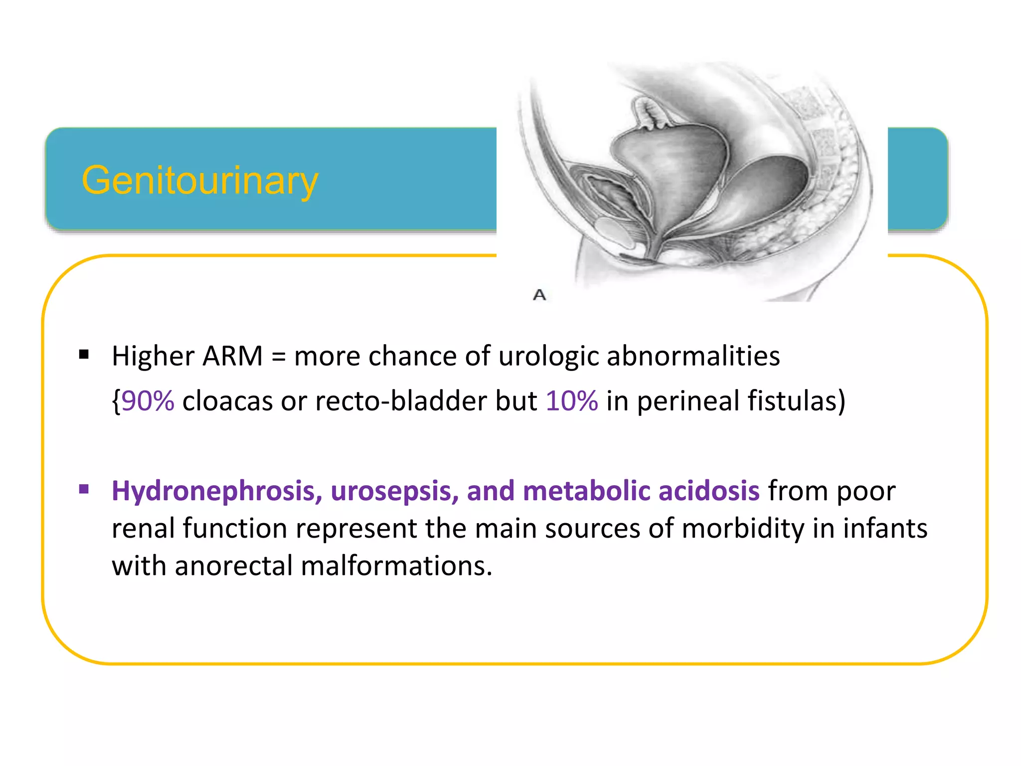 Anorectal malformation ppt 5 | PPT