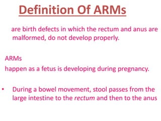 Anorectal malformation ppt 5 | PPT