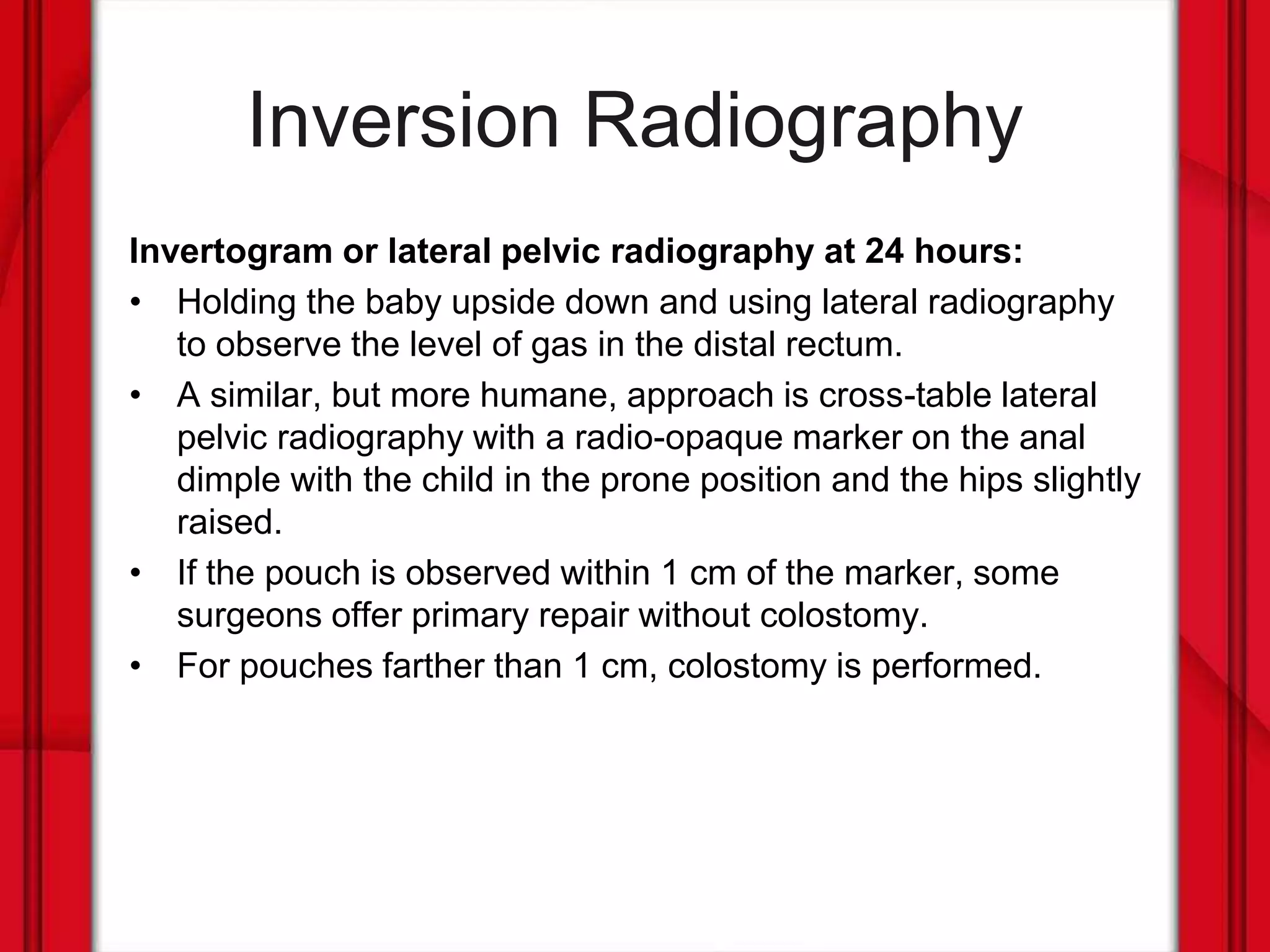 Anorectal malformations | PPTX