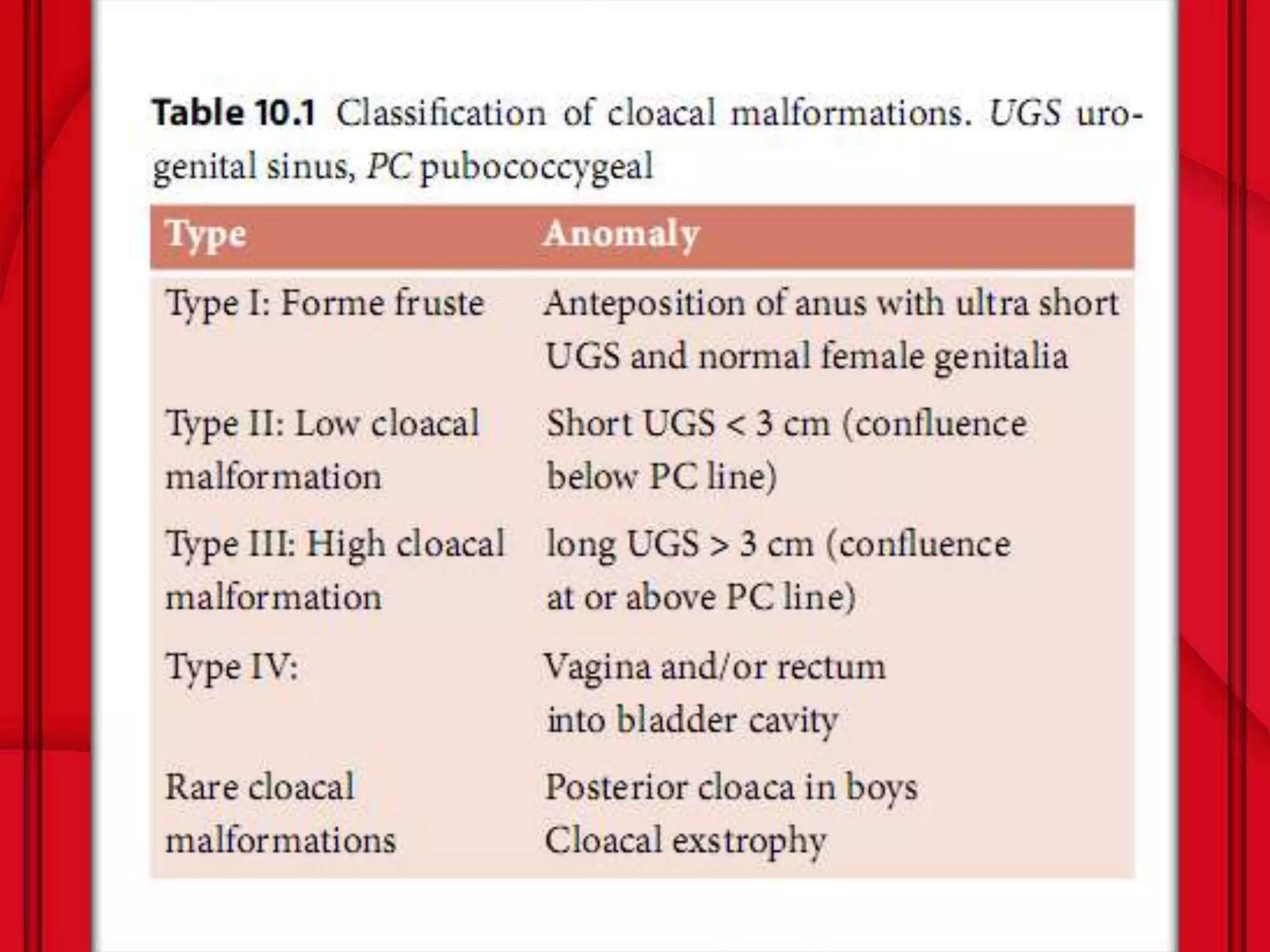 Anorectal malformations | PPTX