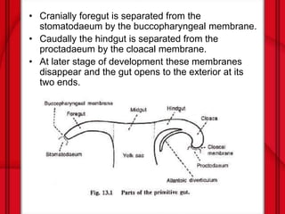 Anorectal malformations | PPTX