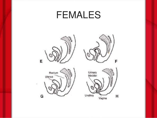 Anorectal malformations
