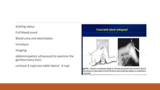 ANORECTAL MALFORMATIONS123456778900.pptx