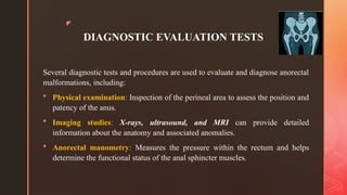 ANORECTAL MALFORMATIONS: NURSING MANAGEMENT PPT.pptx