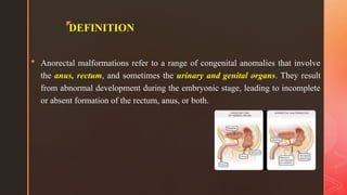 ANORECTAL MALFORMATIONS: NURSING MANAGEMENT PPT.pptx
