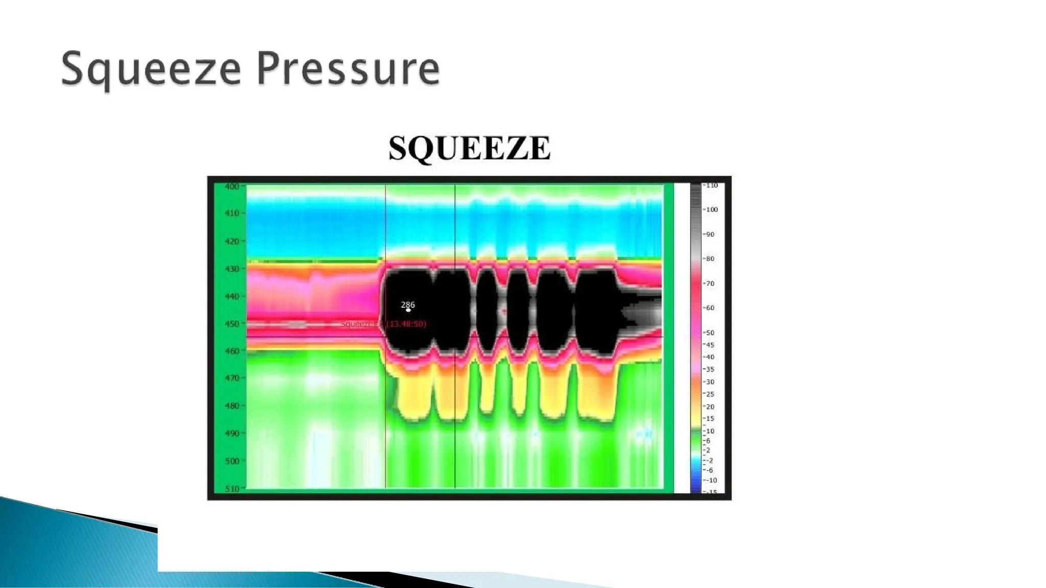 Anorectal Manometry detail presentation . | PPTX