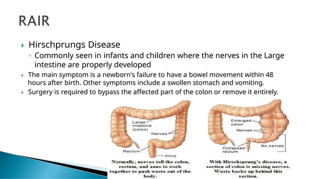Anorectal Manometry detail presentation . | PPTX