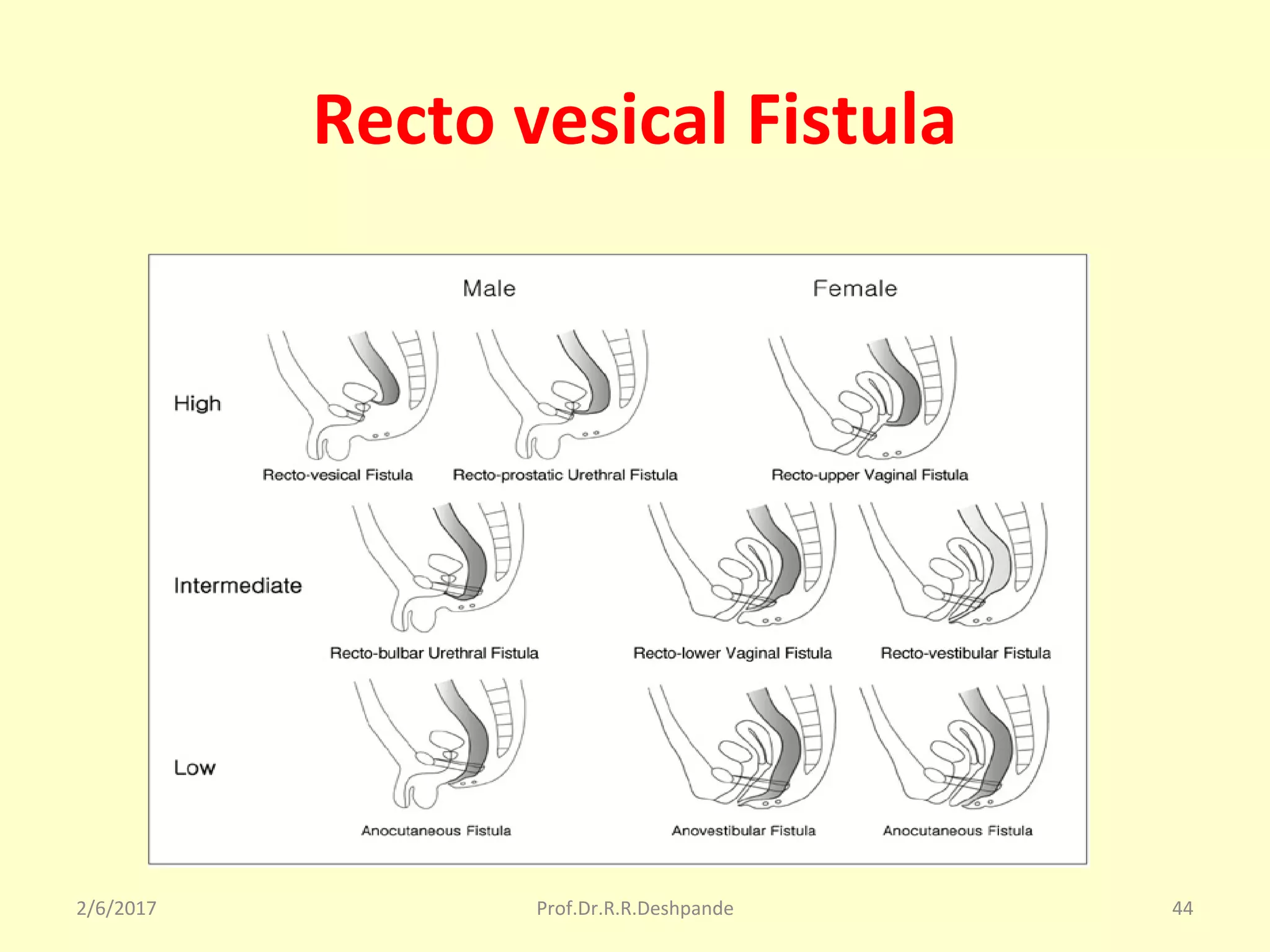Ano rectal problems ppt | PDF