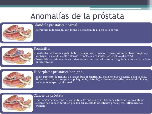 Exploracion fisica: Ano, recto y prostata