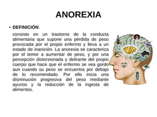 Anorexia | PDF