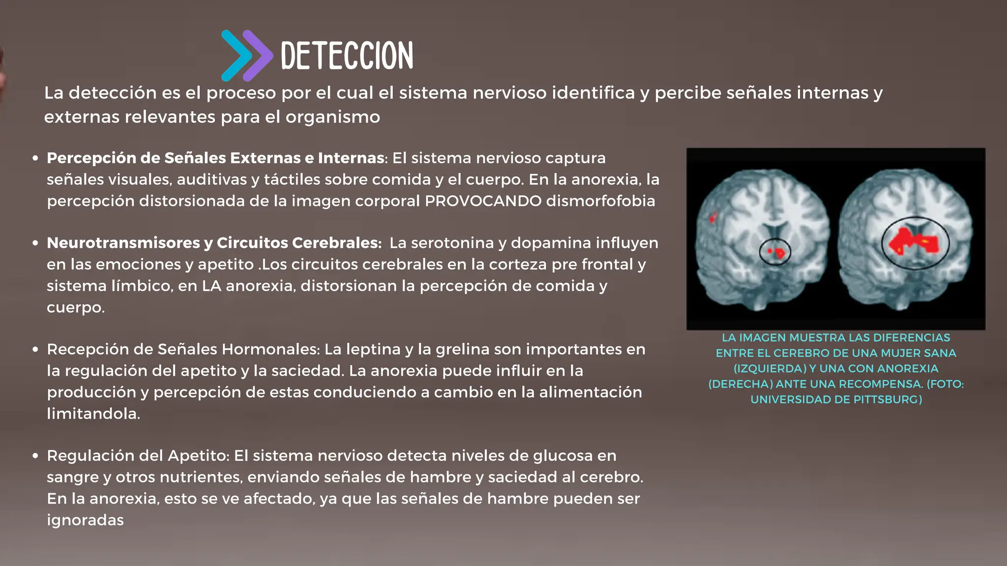 Anorexia.pdf