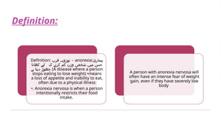 anorexia.pptx according to medical knowledge | PPTX