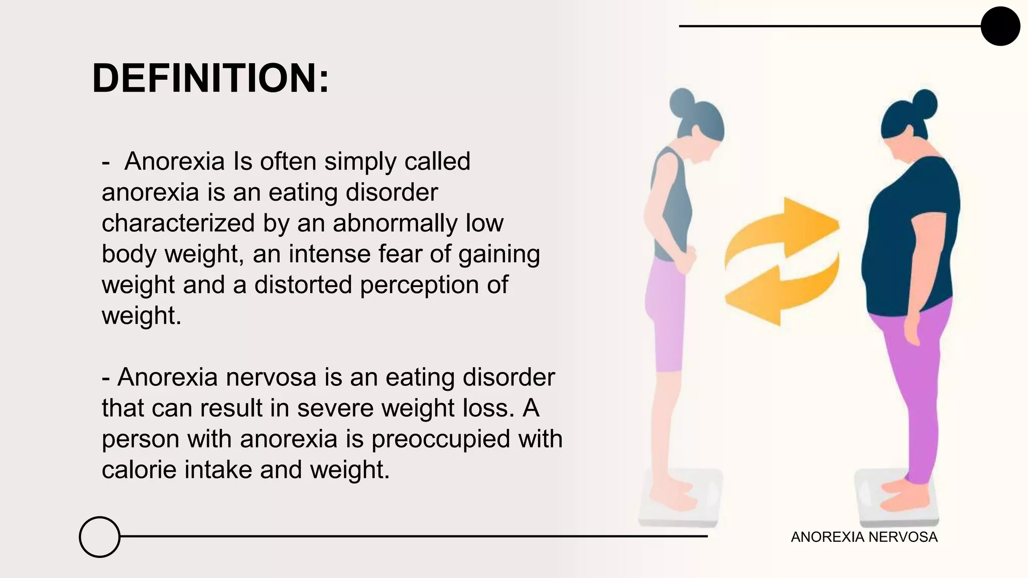 anorexia-NERVOSA.pptx